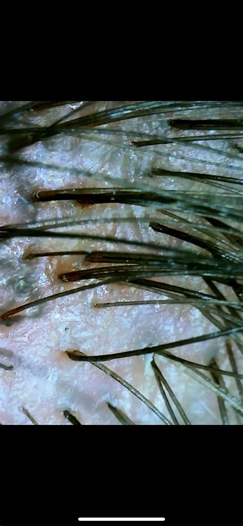 Is This Seb Derm R Sebderm