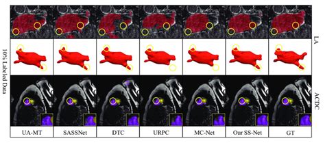Exemplar Results Of Several Semi Supervised Segmentation Methods With