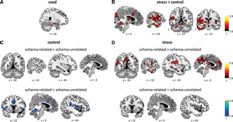 Stress Leads To Aberrant Hippocampal Involvement When Processing Schema
