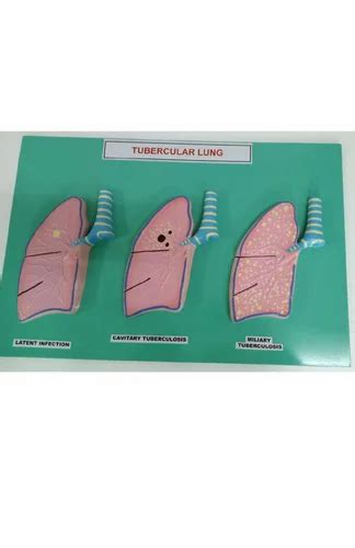 Pvc Tubercular Lungs Model At ₹ 2500piece In Ambala Id 2855959651548
