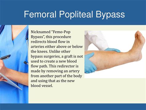 Ppt Common Surgical Operations For Pad Treatment Usa Vascular