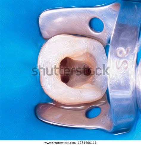 Root Canal Treatment Microscope Over 5 Royalty Free Licensable Stock