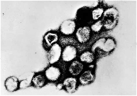 Rubella Virus Morphology Cultivation Pathogenesis Clinical Features