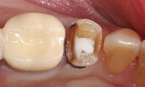 General Dentistry Procedures Smile Gallery Dentist In Humble