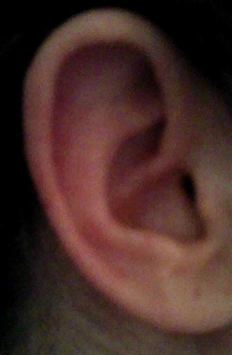 Ear Clog How To Unclog Ears After A Flight All Getaways Artofit