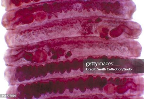Proglottids Of Human Tapeworm Bertiella Studeri Parasite Image