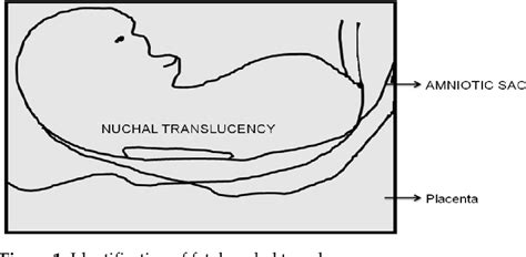 Figure 1 From A Novel Framework For Abnormal Risk Classification Over Fetal Nuchal Translucency