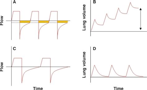 Filebreath Stacking Wikem