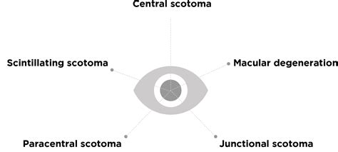 Why Do People Have A Blind Spot In Vision Scotoma Explained Inviocean