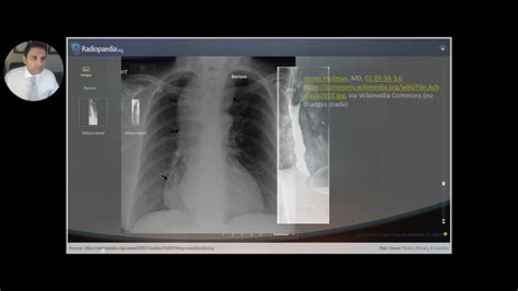 Health Healthcare Healthcareeducation Medicaleducation Medical Meded… Kashif J Piracha