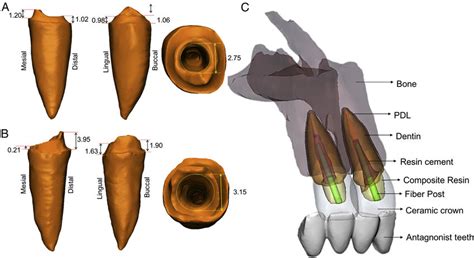 Dimensions Of The Remaining Tooth Structure A The Right Maxillary