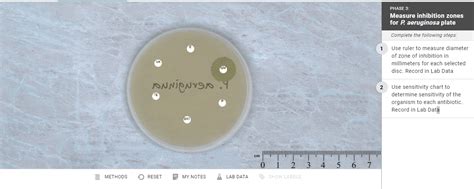 Phase 3 Measure Inhibition Zones For P Aeruginosa