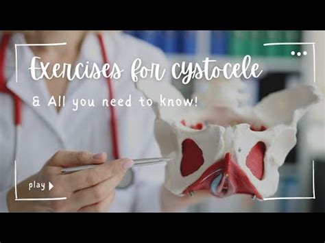 Best Exercises For Cystocele Arogya Physiotips Youtube