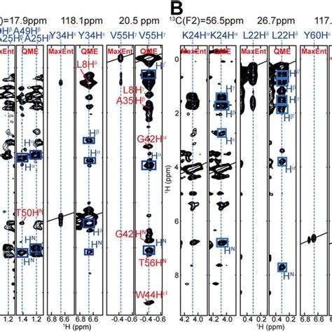 Side By Side Comparison Of In Cell Nmr Protein Structure Determination Download Scientific