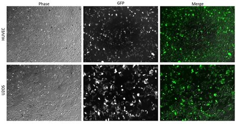 4d Nucleofection Of Huvecs Biocompare Product Review