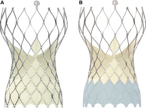 Evolut Pro Plus Valve Mri Safety At Dolores Bennett Blog
