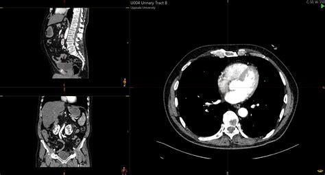Multiplanar Reconstruction Mpr Resource Hub
