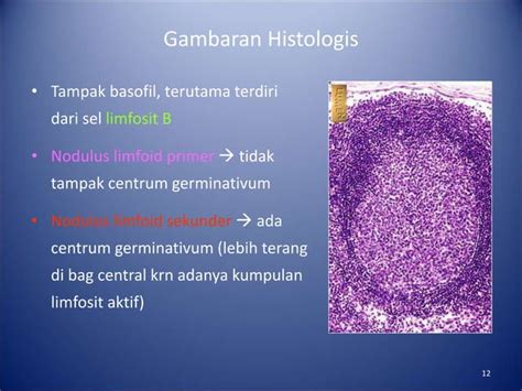 Ppt Histology Sistem Limfatikppt