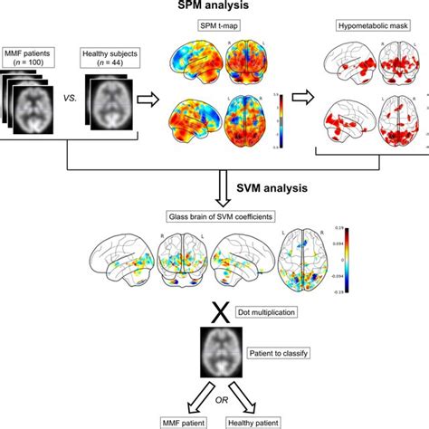 Statistical Parametric Mapping Spm And Support Vector Machine Svm Download Scientific