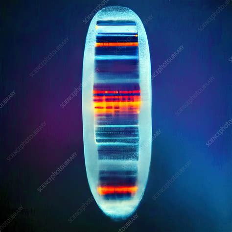Dna Profiling And Genetic Fingerprinting Illustration Stock Image C056 4517 Science Photo