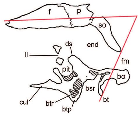 Schematic Based On A Sagittal Section Ct Scan Of The