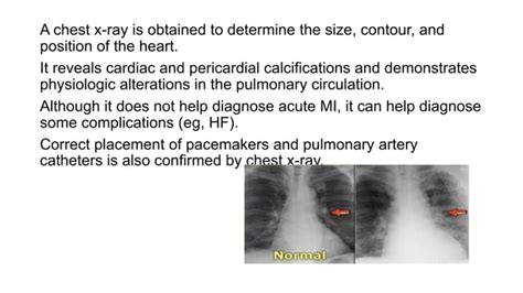 Non Invasive And Invasive Cardiac Monitoringpptx