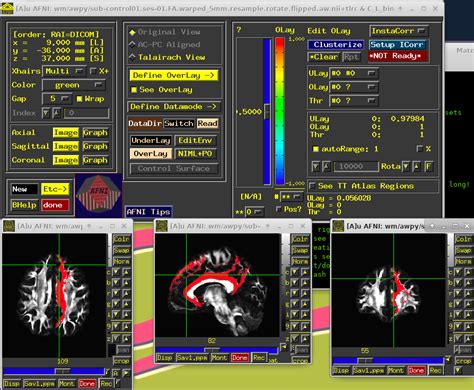 Align Roi To Fa Map Afni Message Board Afni Discuss Message Board
