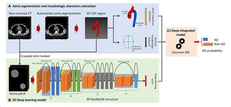 Overview Of The Model Construction For Aortic Detection A The