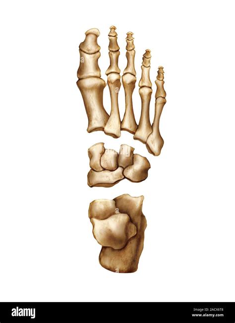 Illustration Of The Talipes Or Foot Deformations From The Anatomical