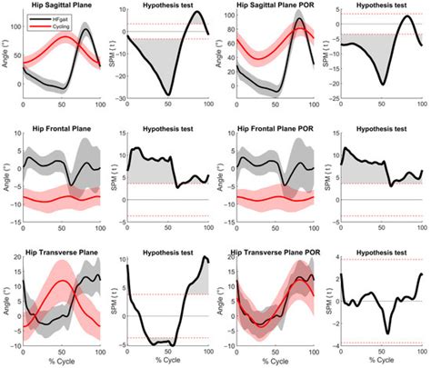 Comparison Of Lower Limb Kinematics Between Increased Hip Flexion Gait