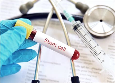 Stem Cell Injection Premier Clinic For Her