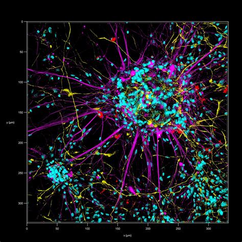 Leica Microsystems On Linkedin Thunder Imager Tissue