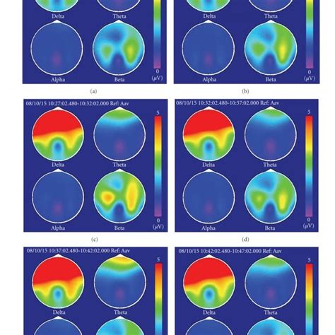 Af The Power Spectrum Maps Of Eeg In The Six Sessions Of One