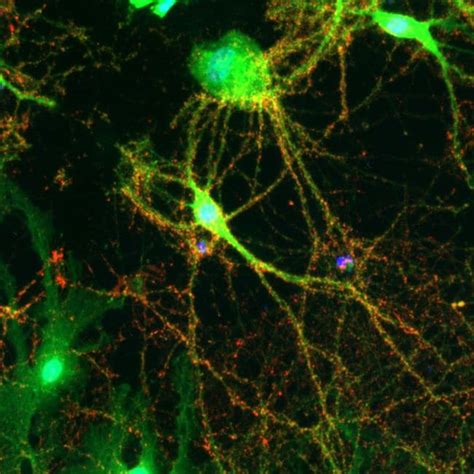 Synaptophysin Antibody Pa1 1043