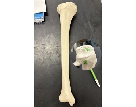 Irl Tibia Labeling Lab 4 Quiz