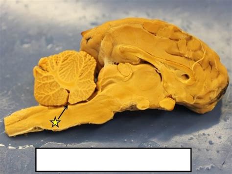 Sheep Brain Dissection Flashcards Quizlet