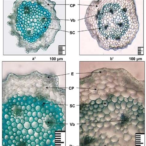 Anatomical Structure Of The Pedicel A Praemixtum In Conditions Of