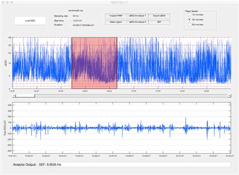 Neonatal EEG Analysis Toolbox NEAT Neonatal Neurology Physiology Research Lab Washington