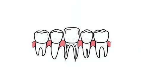 Teeth Gums Stock Vector Illustration Of Patient Care 68156119
