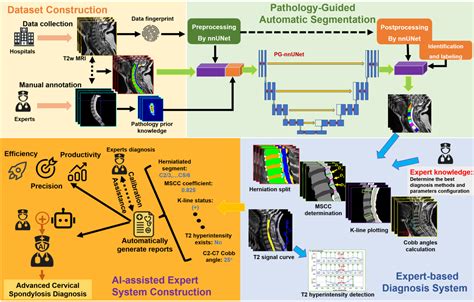 논문 리뷰 Pathology Guided Ai System For Accurate Segmentation And Diagnosis Of Cervical Spondylosis