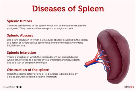 Human Anatomy Organs Spleen