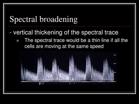 Ppt Spectral Analysis Powerpoint Presentation Free Download Id4739521