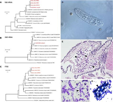 Phylogenetic and microscopic analyses of Philaster sp. in abnormal D.... | Download Scientific ...