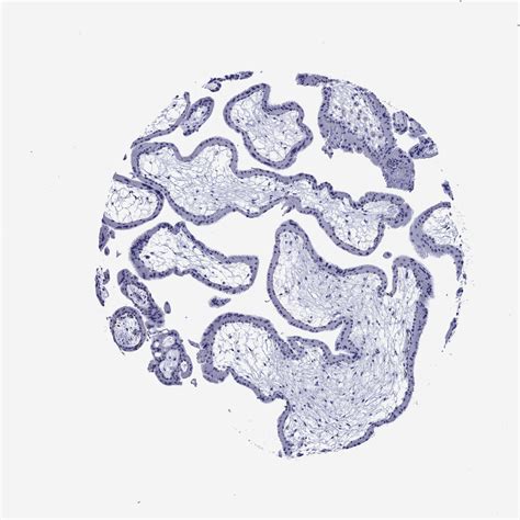 Tissue Expression Of Slc1a2 Staining In Placenta The Human Protein Atlas
