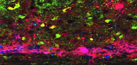 Hyperactive Spinal Cord Circuitry Harms Immune System After Failed
