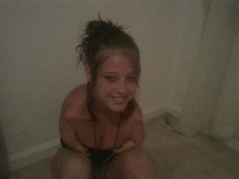 Phocomelia Girl Imgur