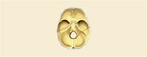 Longitudinal Temporal Bone Fracture Vs Transverse Temporal Bone Fractu