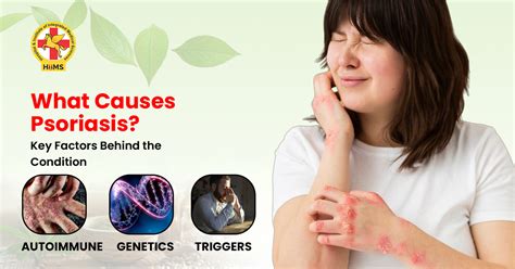 What Causes Psoriasis Key Factors Behind Skin Flare Ups