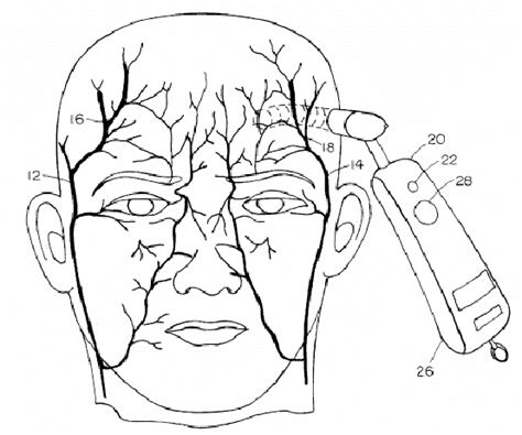 Scanning The Temporal Artery Download Scientific Diagram