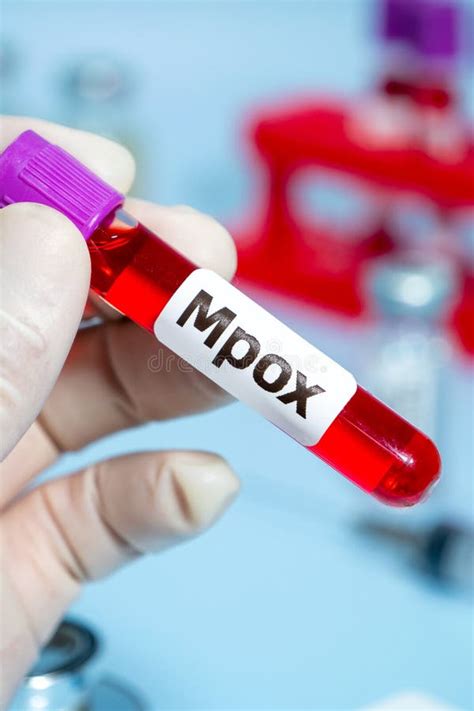 Blood Collection Tubes Mpox Test Positive Results WHO To Rename